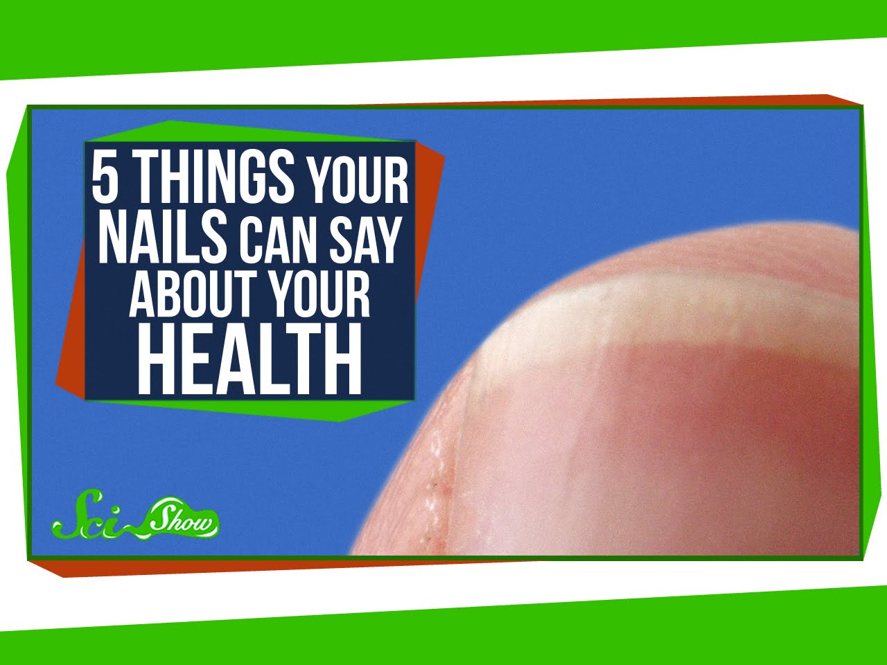 5 Things Your Nails Can Say About Your Health | ERA Observer