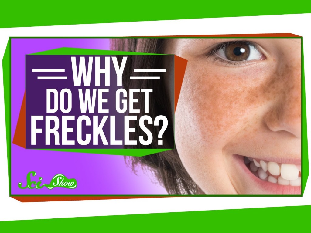 Why Do We Get Freckles? | ERA Observer