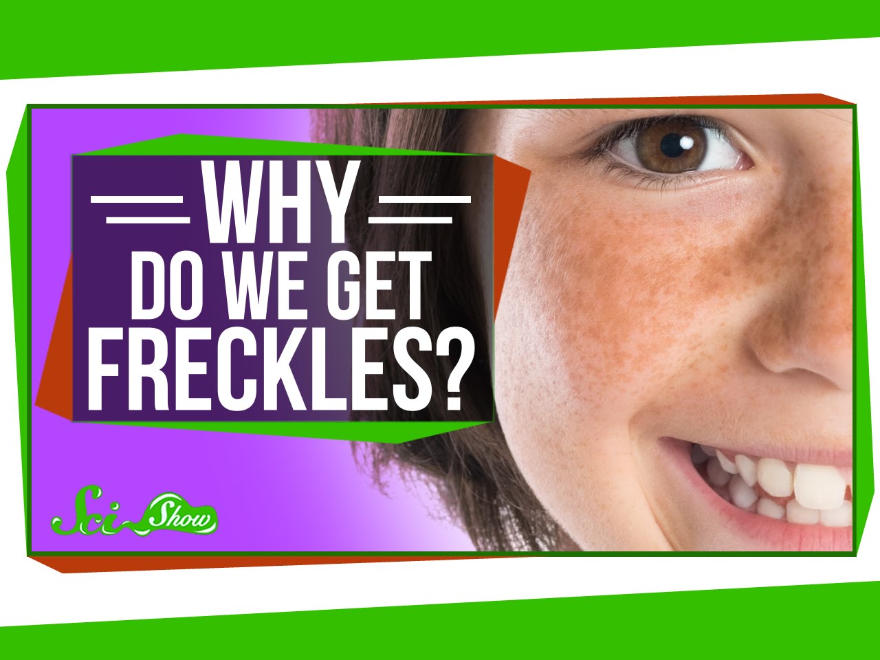 Why Do We Get Freckles? | ERA Observer